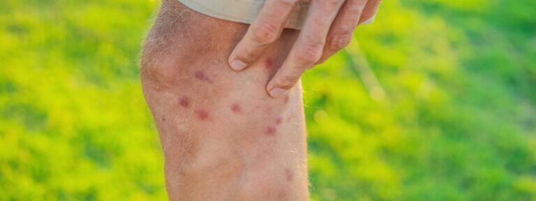 What does a bed with bud bugs look like? - Latest 2024 data